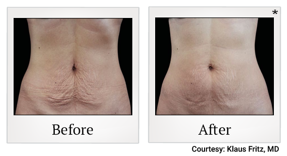 Emtone Oakland | Emtone Fremont